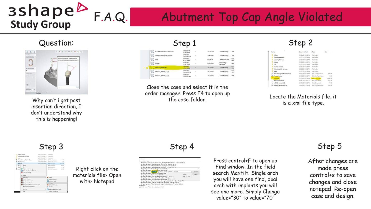 How To Fix “Abutment Top Cap Angle Violated” Error in 3shape – DentalTechTips